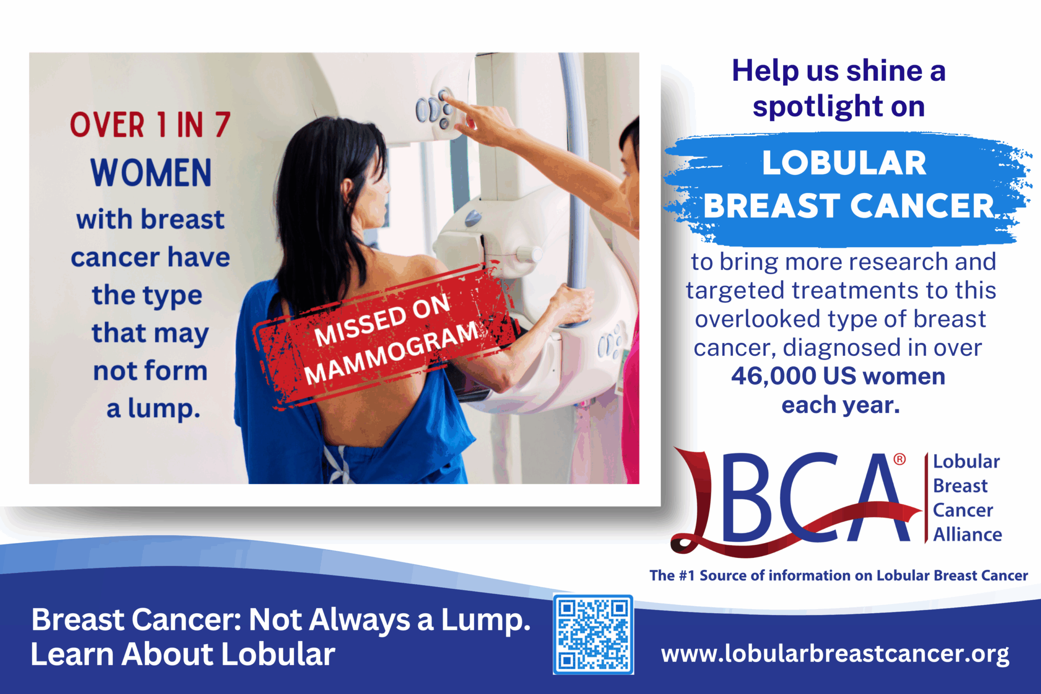 LBCA Missed On Mammogram Poster/Slide - The Lobular Breast Cancer Alliance